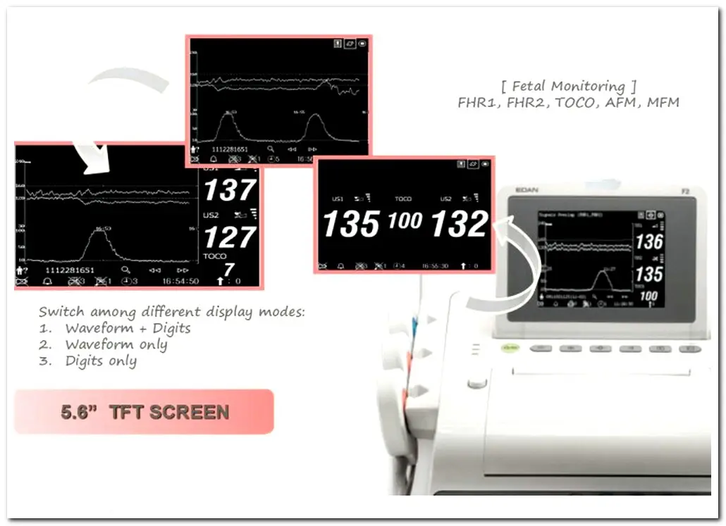 F2 Fetal Monitoring Devices Edan Monitor: Ensuring Precise Obstetrical Care