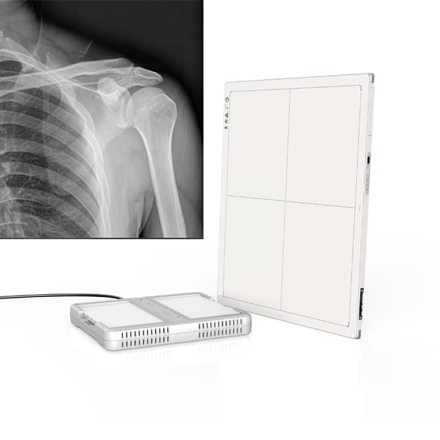 Portable X Ray Machine With Flat Panel Detector: Revolutionizing ...
