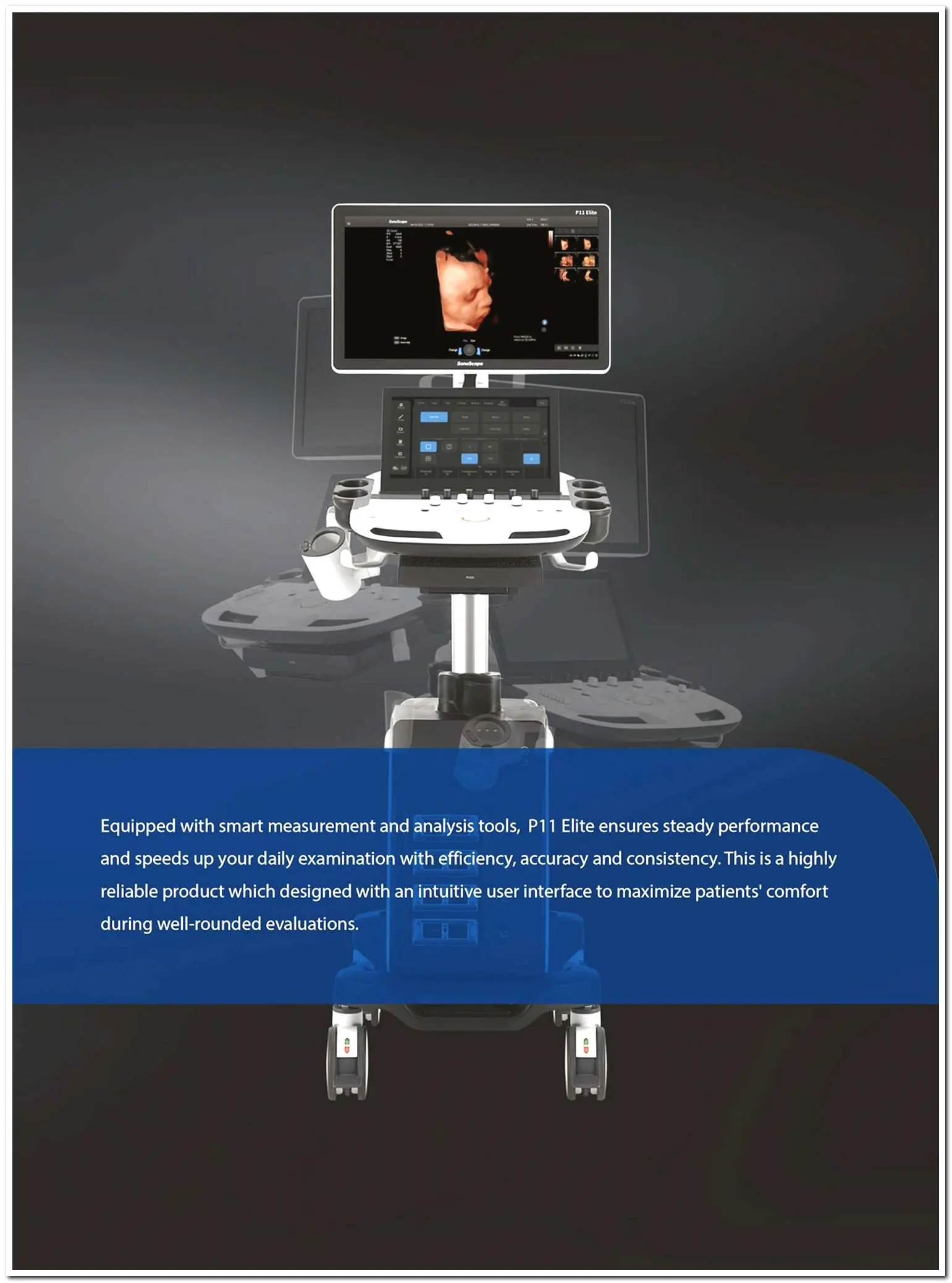 Sonoscape P11 Elite OB Trolley 4D Color Doppler Ultrasound Machine ...